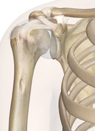 The Shoulder Joint Anatomy And 3D Illustrations